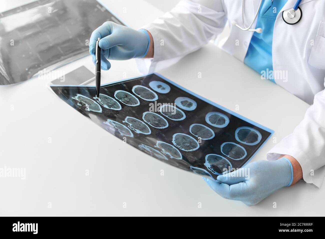 Senior neurologist with MRI scan of human head in clinic Stock Photo ...