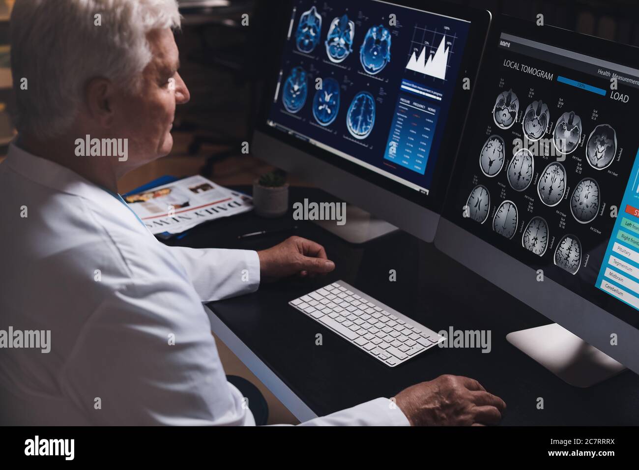 Senior neurologist with MRI scan of human head in clinic Stock Photo ...