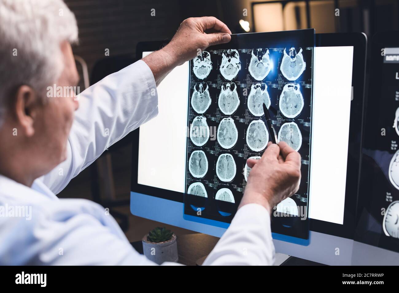 Senior neurologist with MRI scan of human head in clinic Stock Photo ...