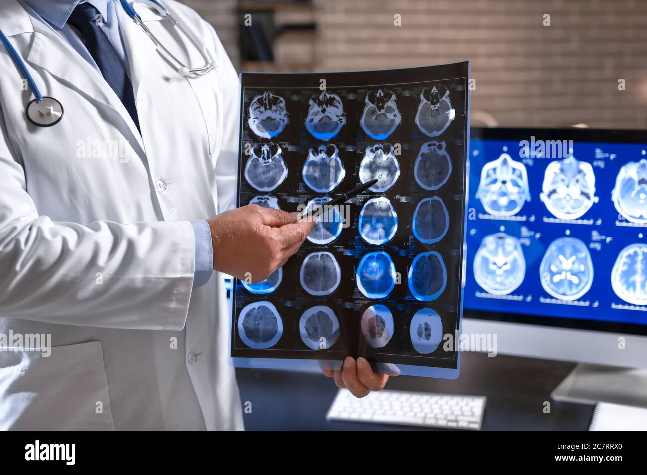 Senior neurologist with MRI scan of human head in clinic Stock Photo ...