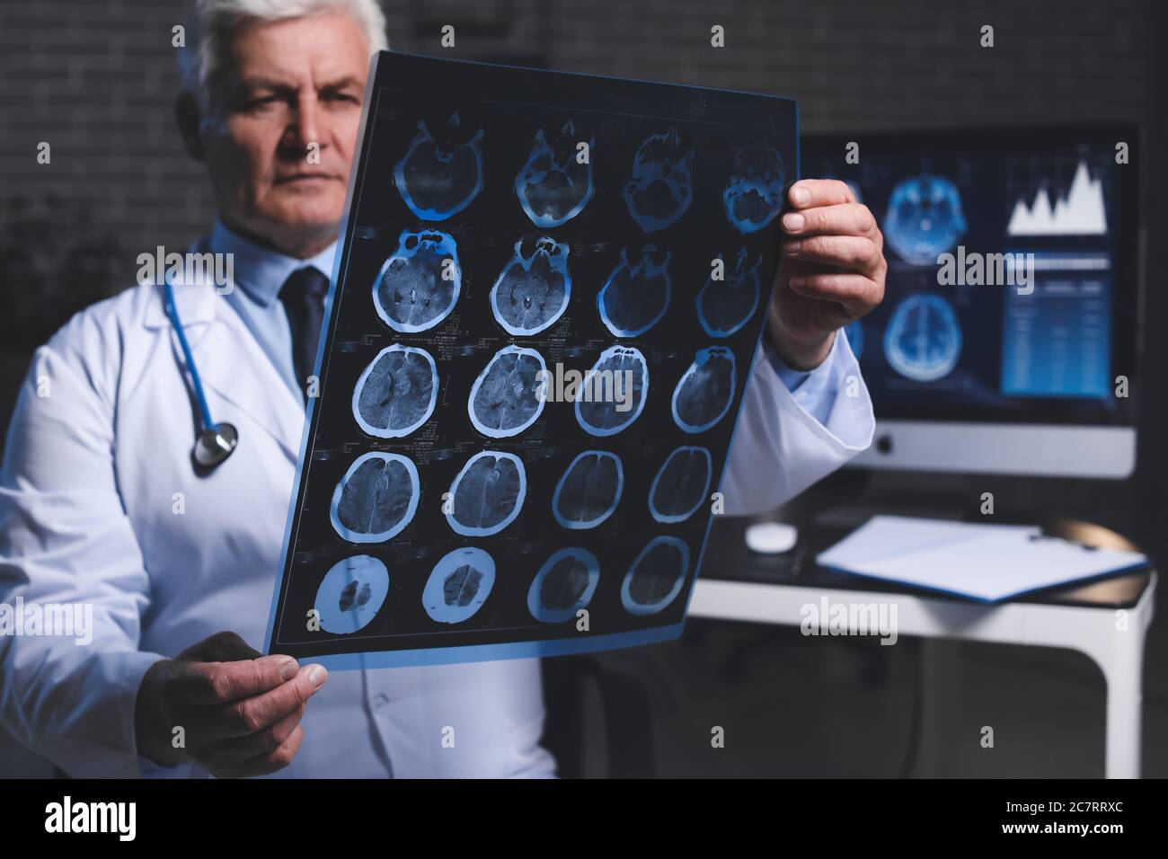 Senior neurologist with MRI scan of human head in clinic Stock Photo ...