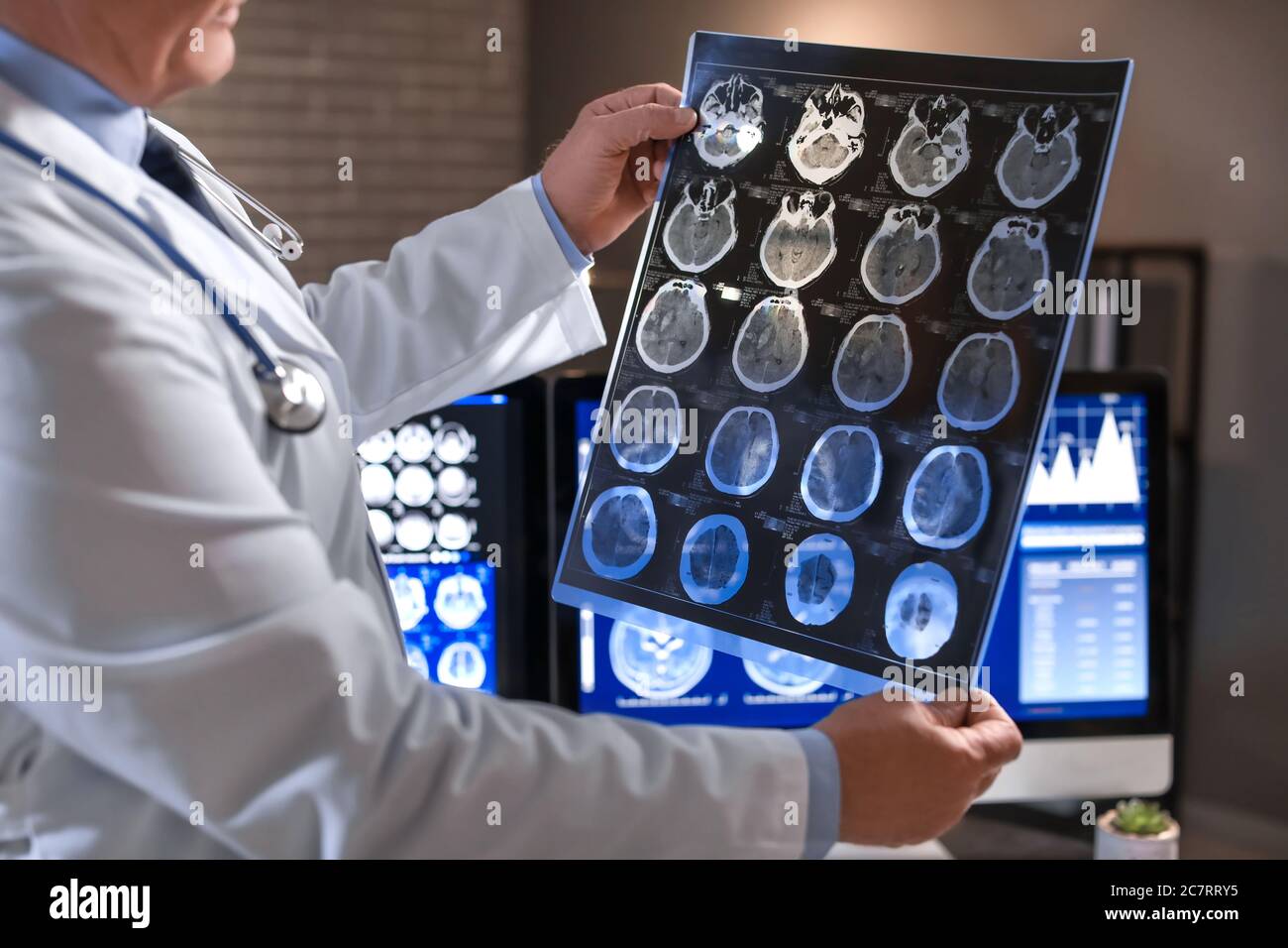 Senior neurologist with MRI scan of human head in clinic Stock Photo ...