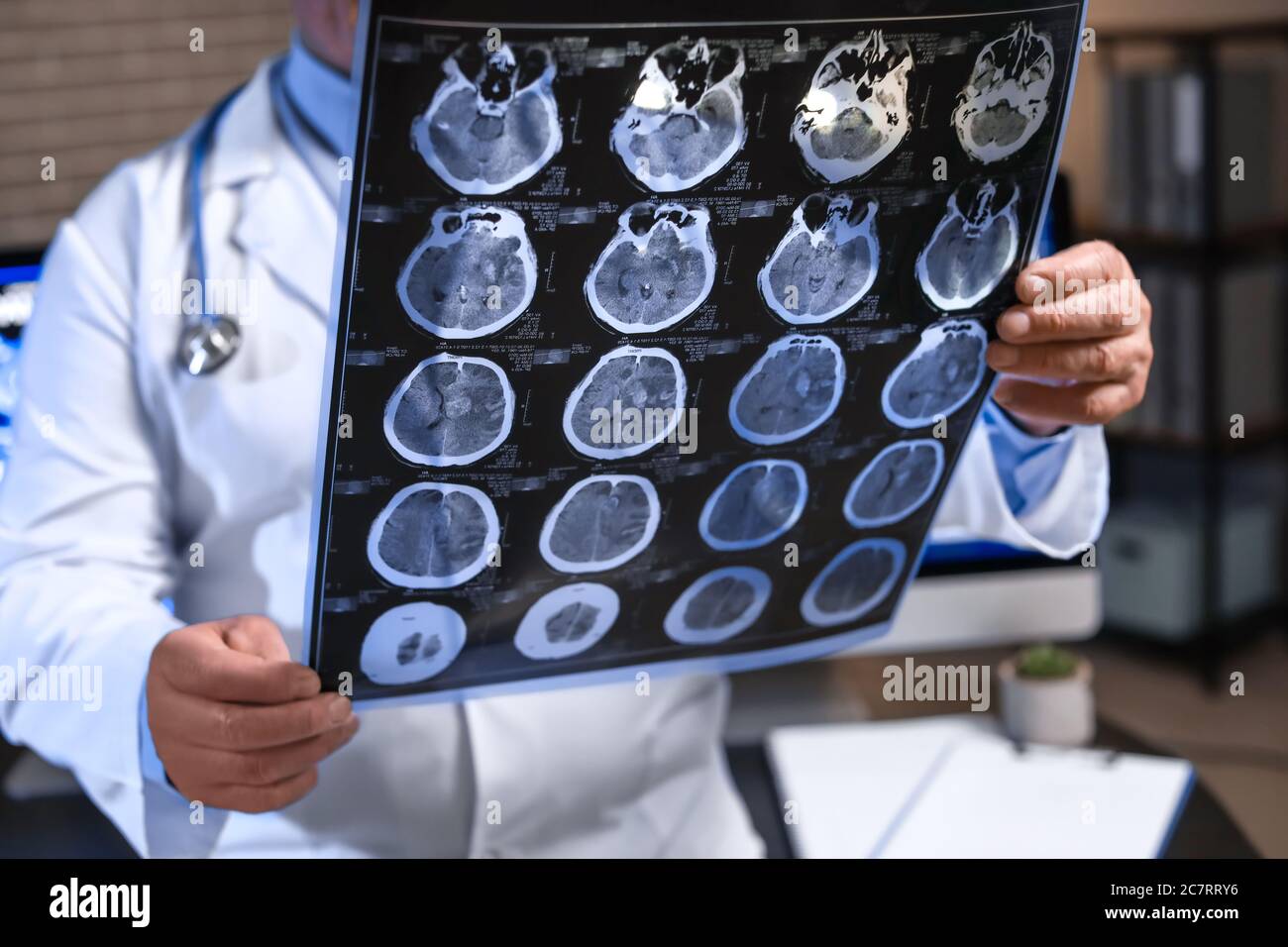 Senior neurologist with MRI scan of human head in clinic Stock Photo ...