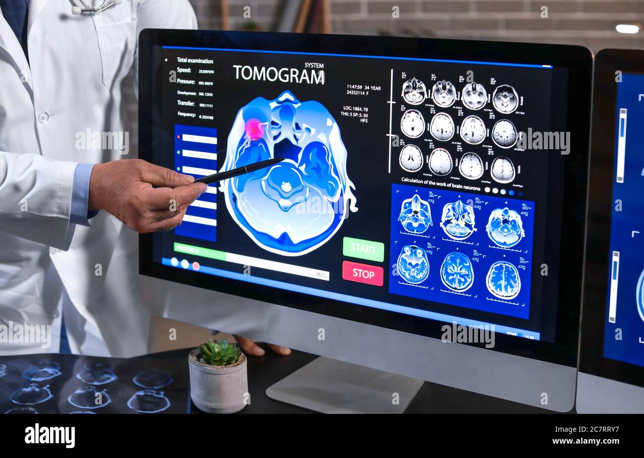 Senior neurologist with MRI scan of human head on screen of computer ...