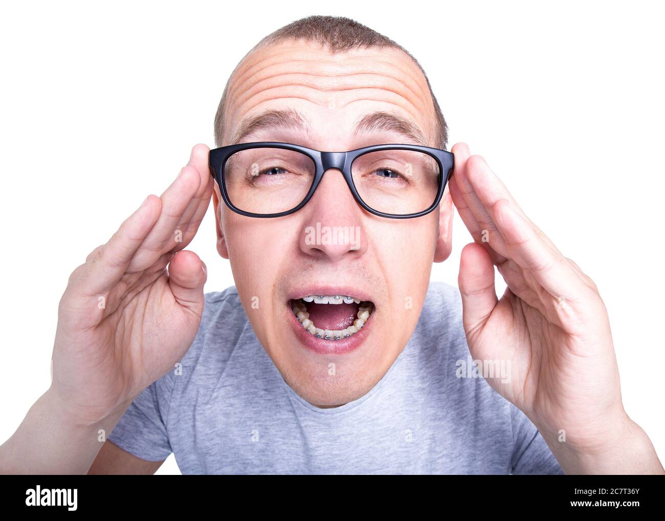 poor eyesight concept - funny young man in glasses with braces on teeth ...