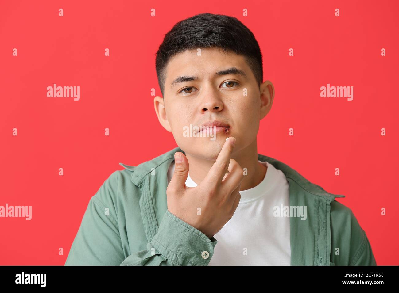 Asian man with cold sore applying ointment on his lips against color background Stock Photo - Alamy