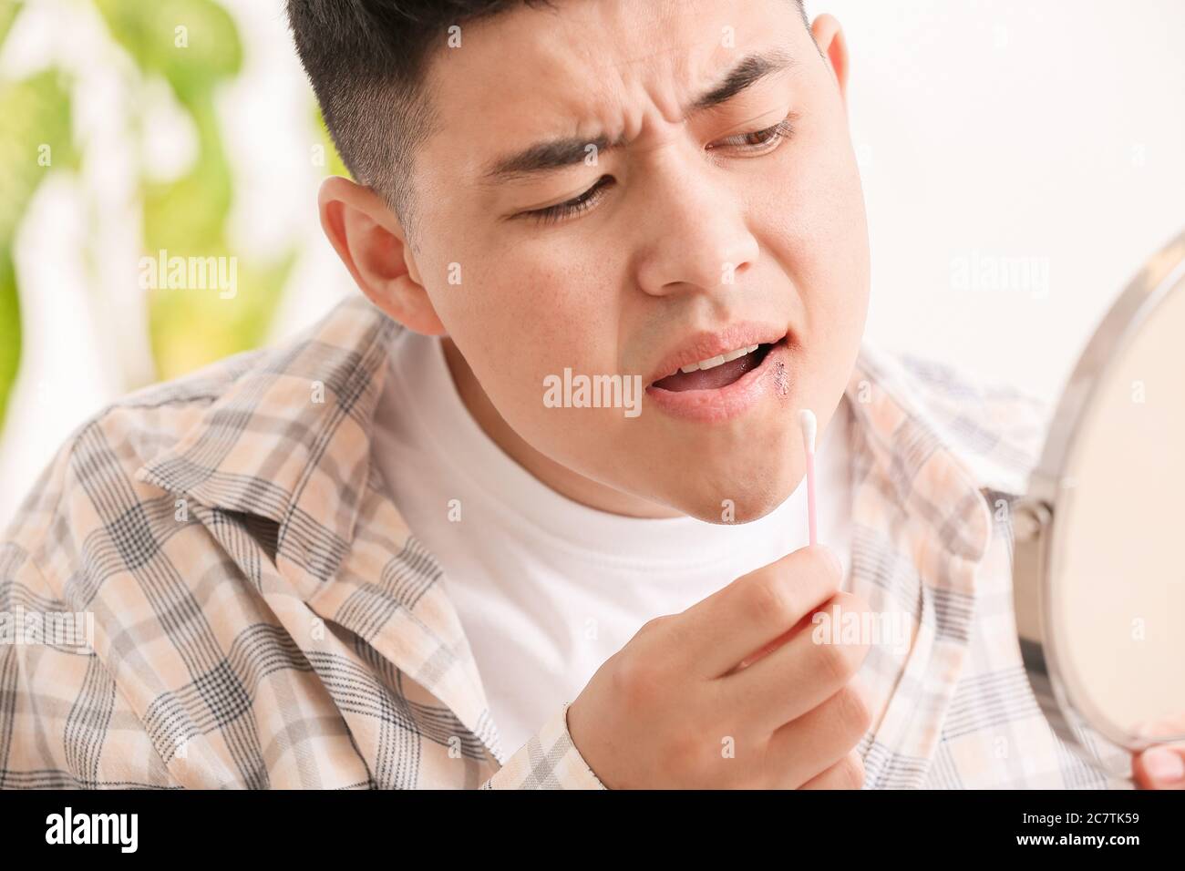 Asian man with cold sore applying ointment on his lips Stock Photo - Alamy