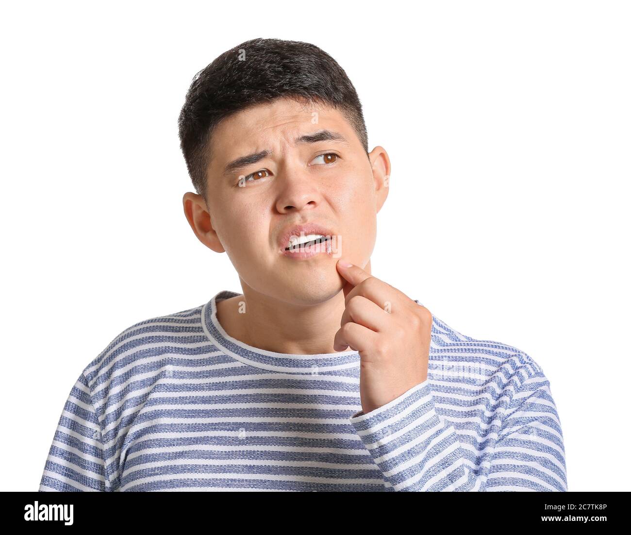 Asian man with cold sore on white background Stock Photo - Alamy