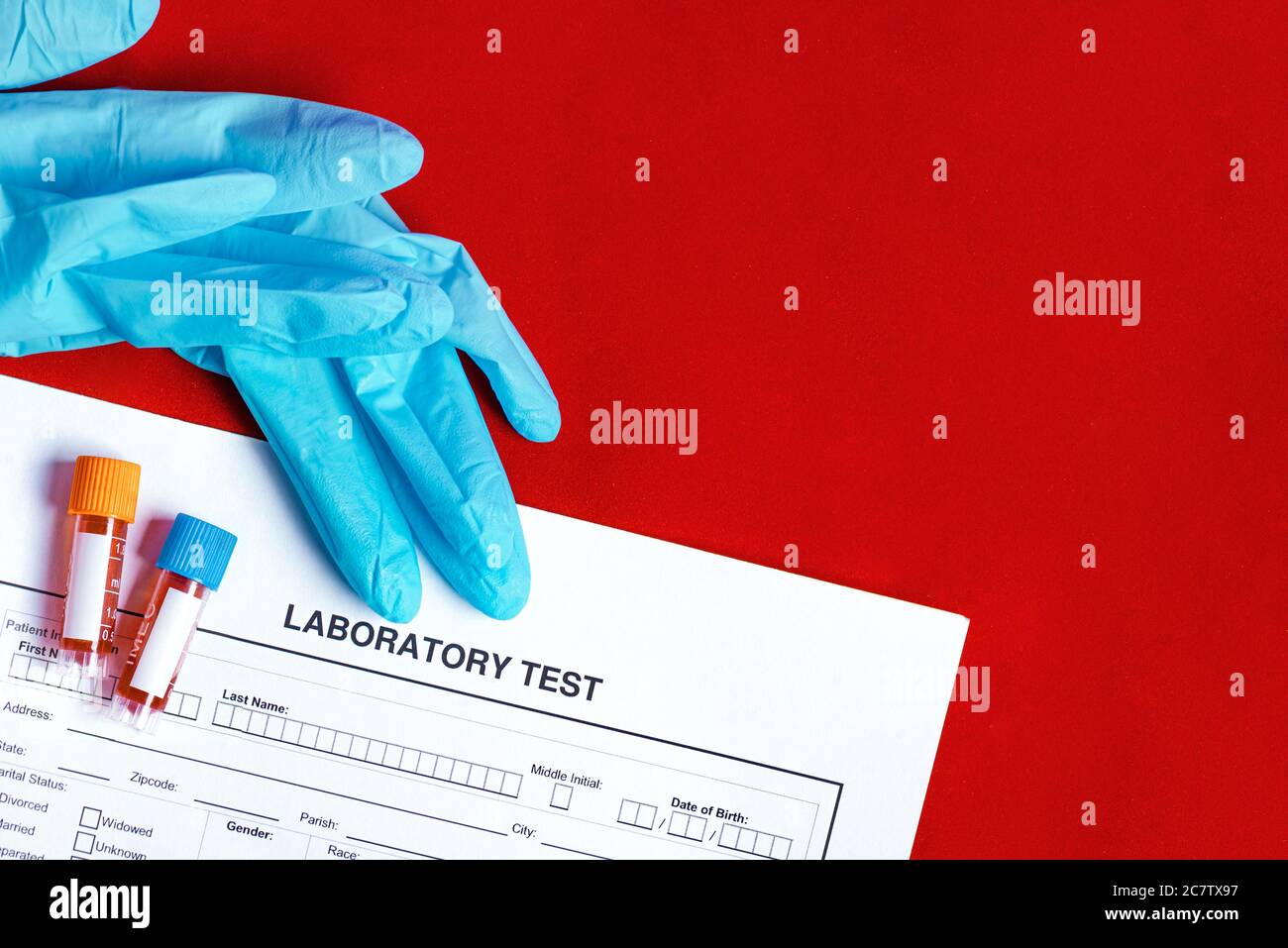 Red test tubes hi-res stock photography and images - Alamy