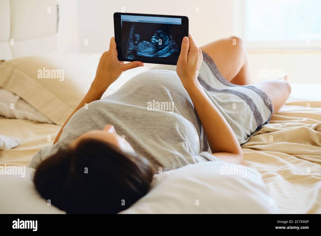 Baby scan hi-res stock photography and images - Alamy