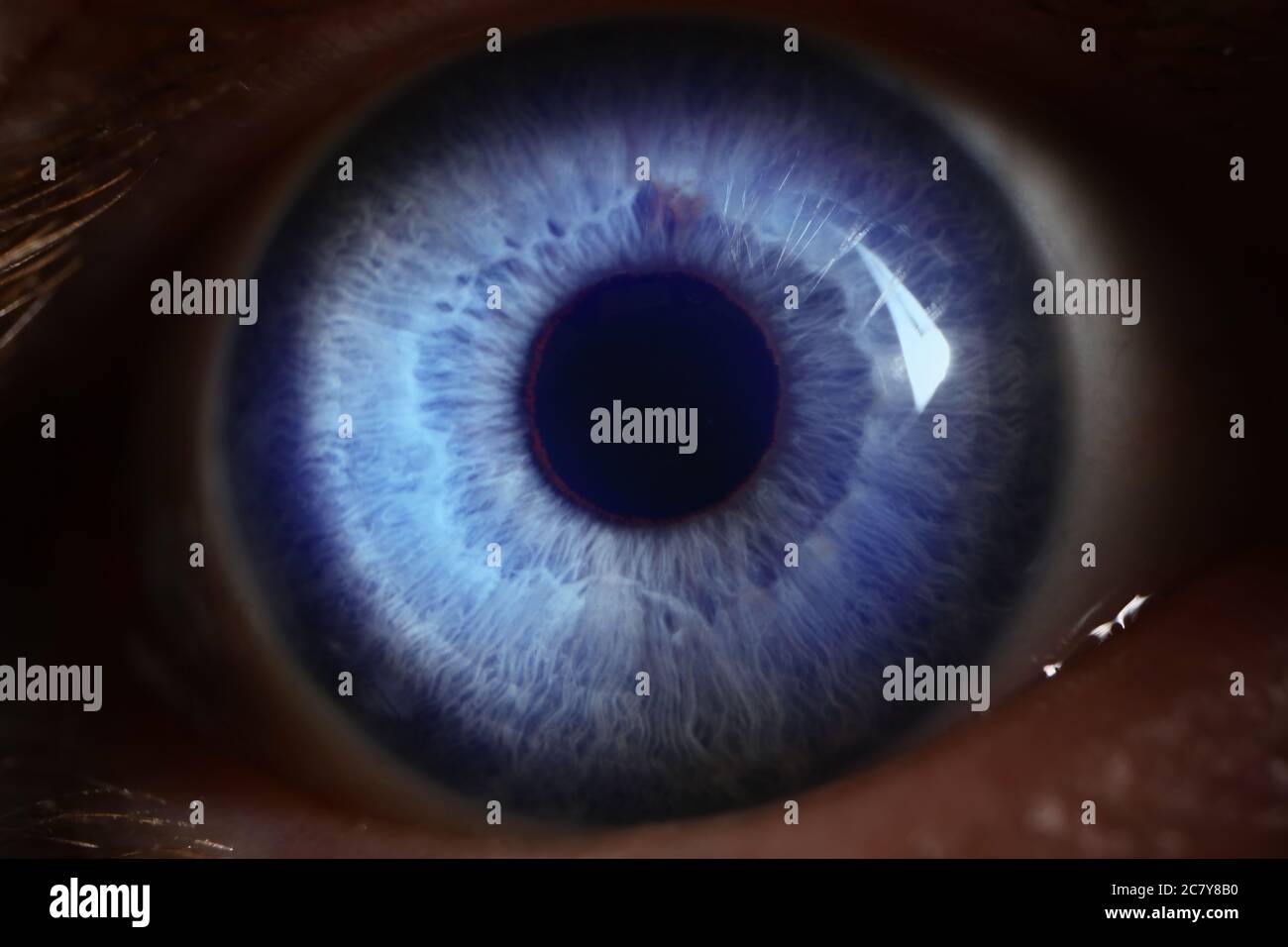 Human blue eye with light straight on it Stock Photo - Alamy