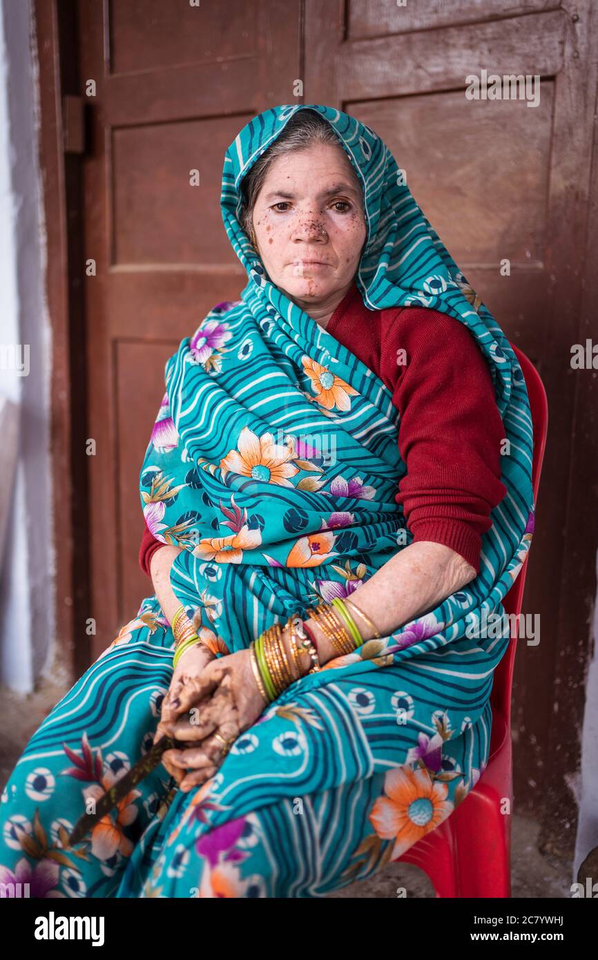 Leprosy face hi-res stock photography and images - Alamy