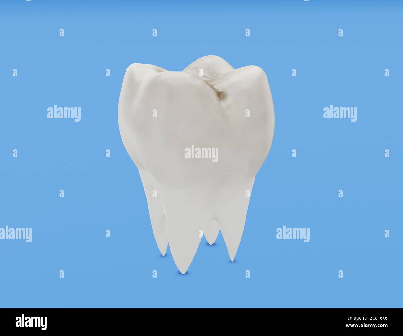 one molar tooth, tooth decay, caries. 3d illustration Stock Photo - Alamy