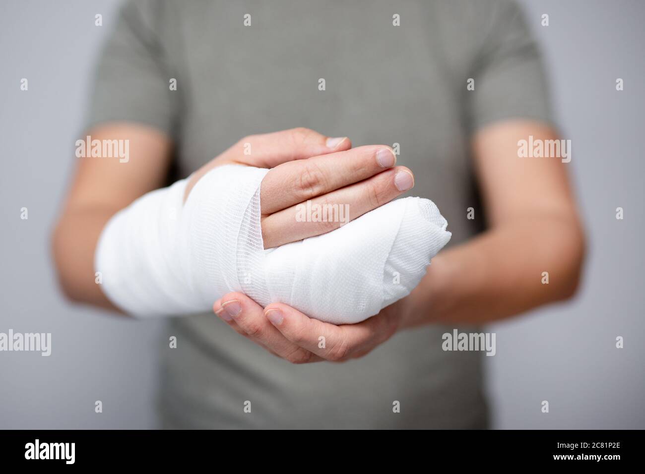 first aid concept - close up of broken male hand with bandage and ...