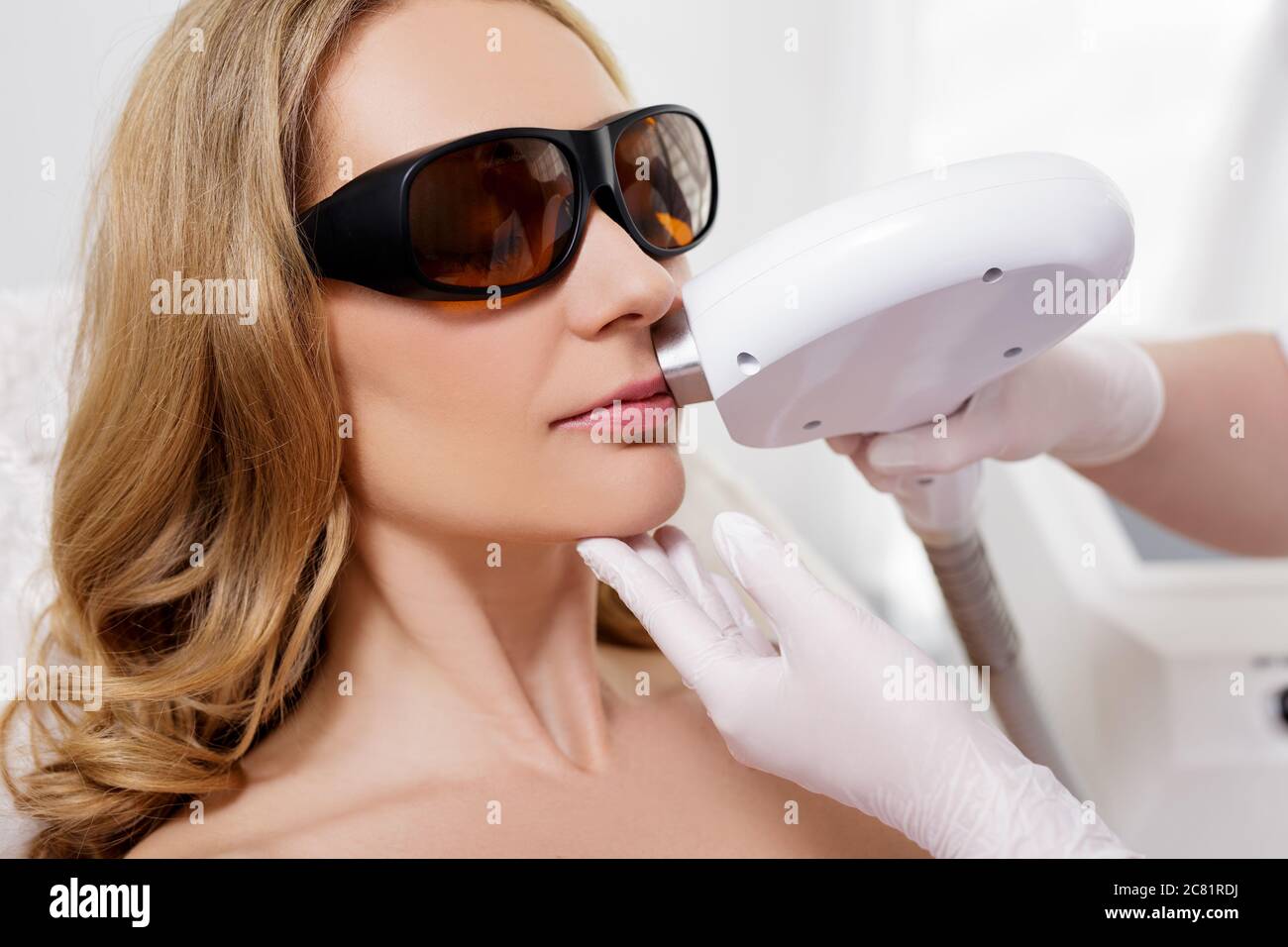 laser epilation and beauty concept - portrait of young beautiful woman ...