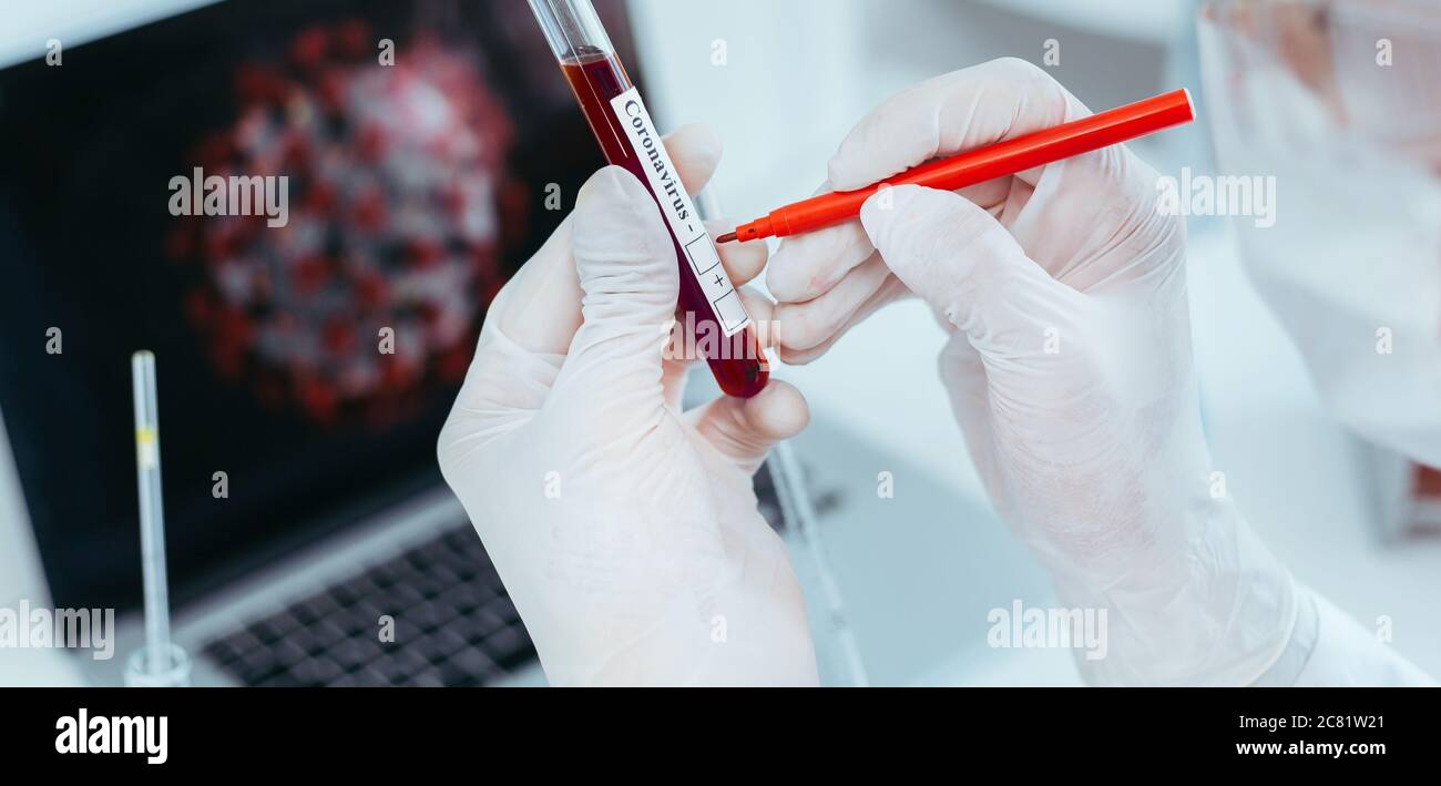 close up. scientist marking a tube with a test Stock Photo - Alamy