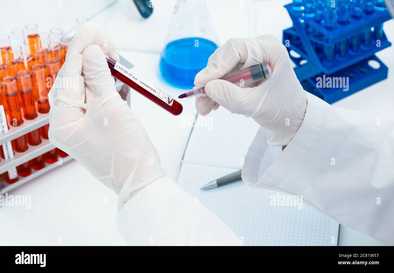 Lab verified hi-res stock photography and images - Alamy