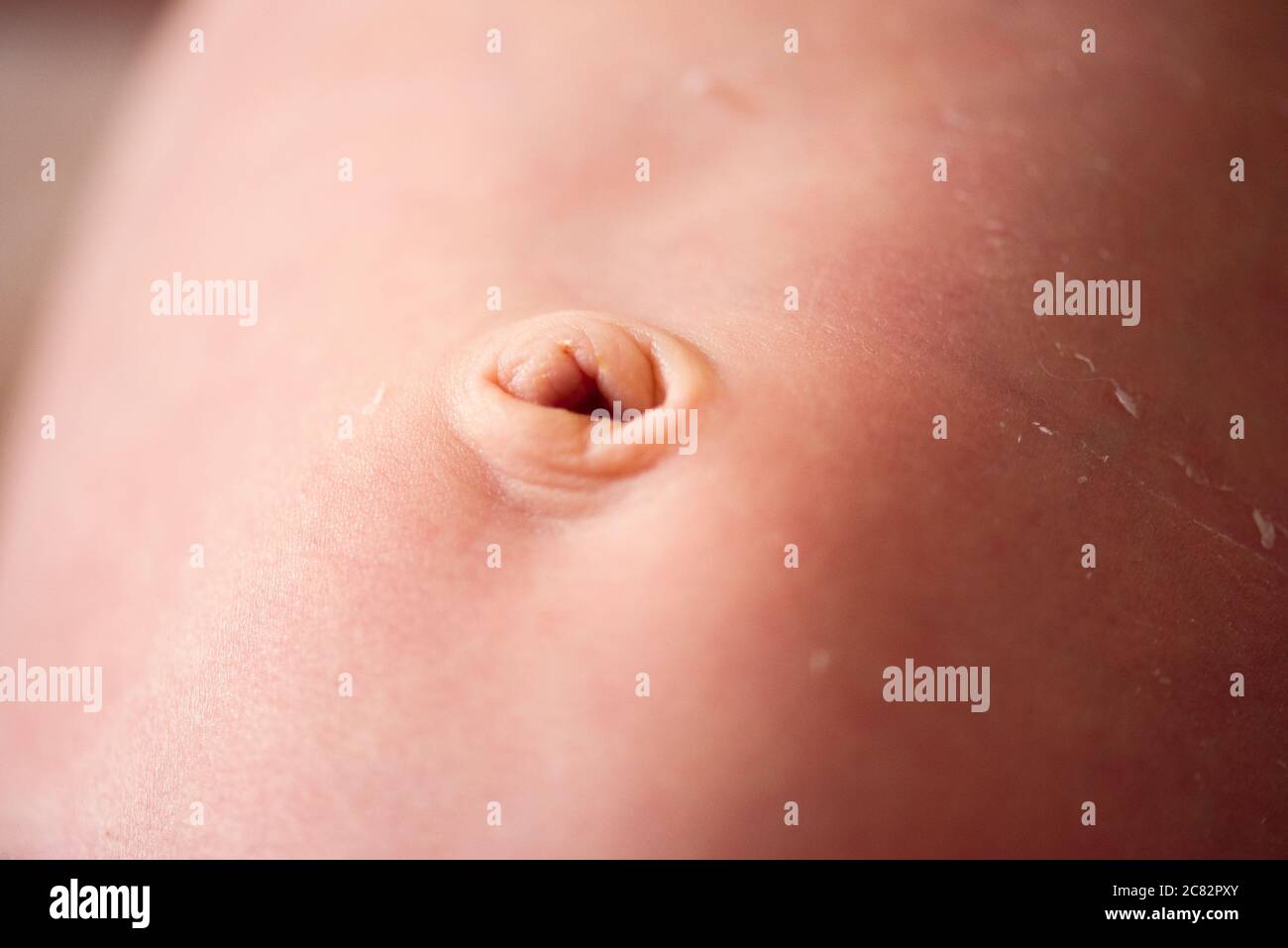 Normal Belly Buttons Belly Button Pain: 17 Causes (& How To Treat)