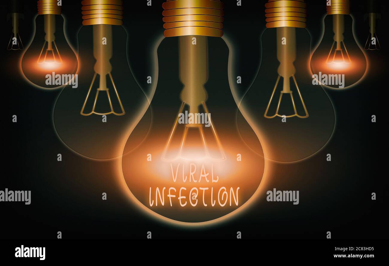 Text sign showing Viral Infection. Business photo showcasing Specific ...