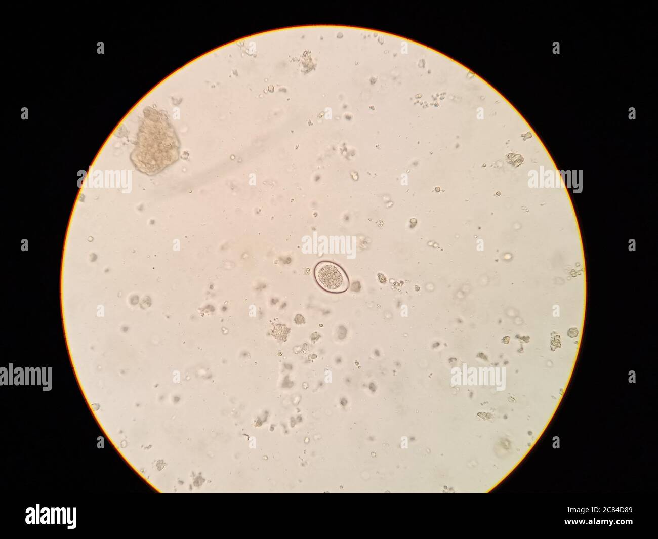 isospora spp oocyst under microscope Stock Photo - Alamy