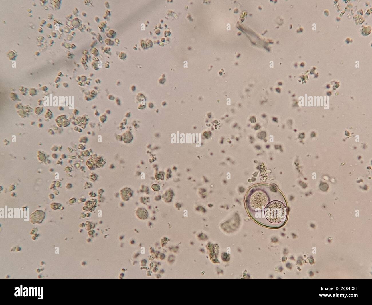 isospora spp oocyst under microscope Stock Photo - Alamy