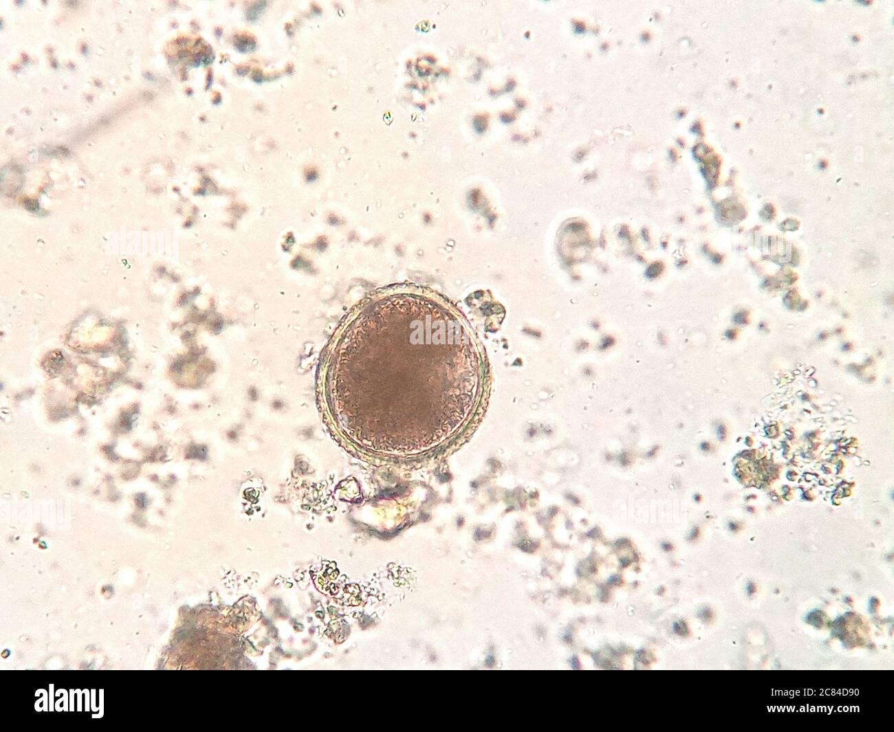 toxocara cati ova Stock Photo - Alamy