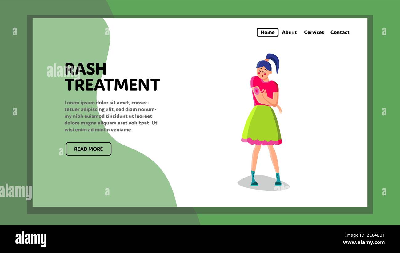 Rash Treatment Young Woman Body Medicine Vector Stock Vector Image ...