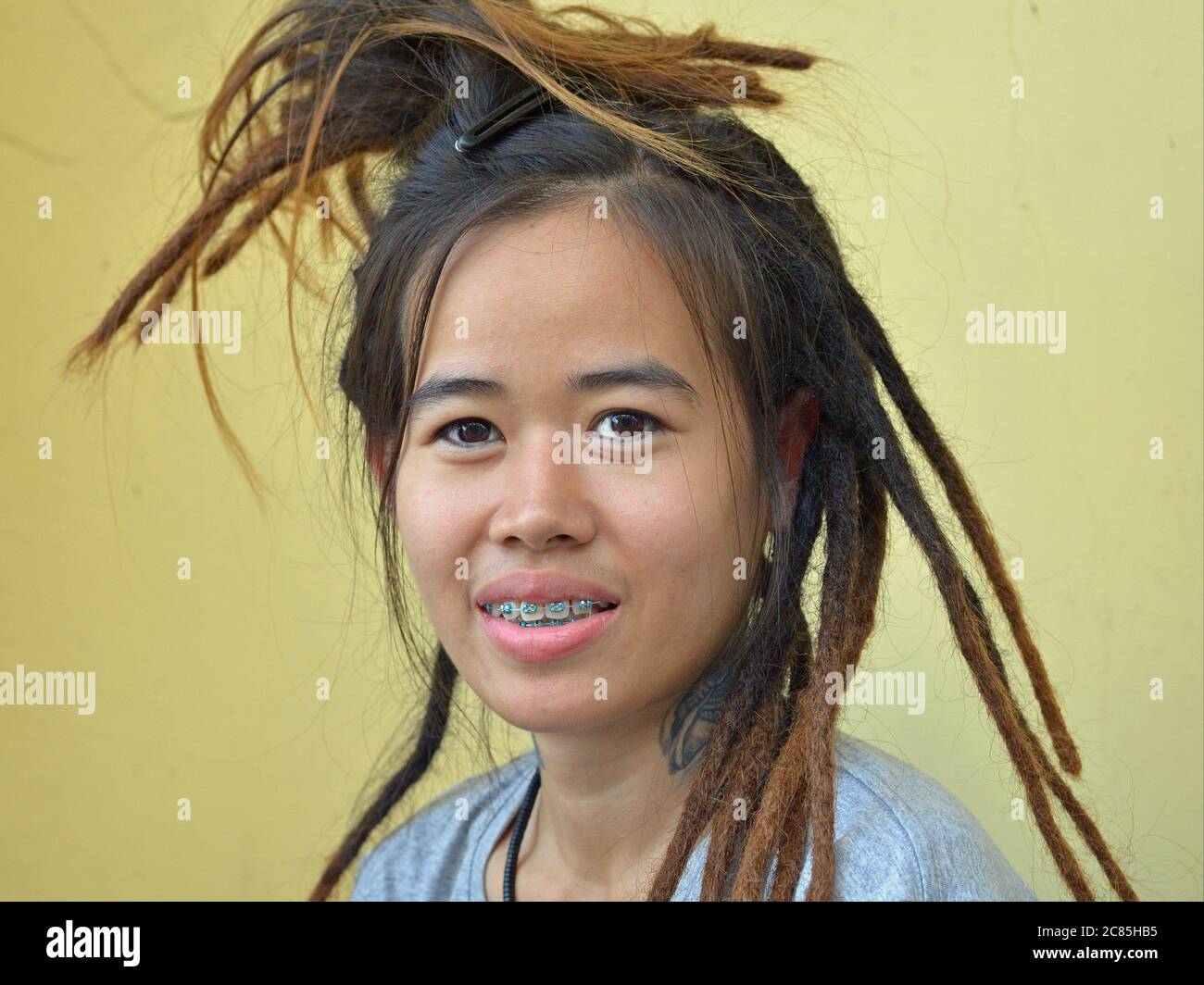 Young Thai woman with blue dental braces and long, only half-finished ...
