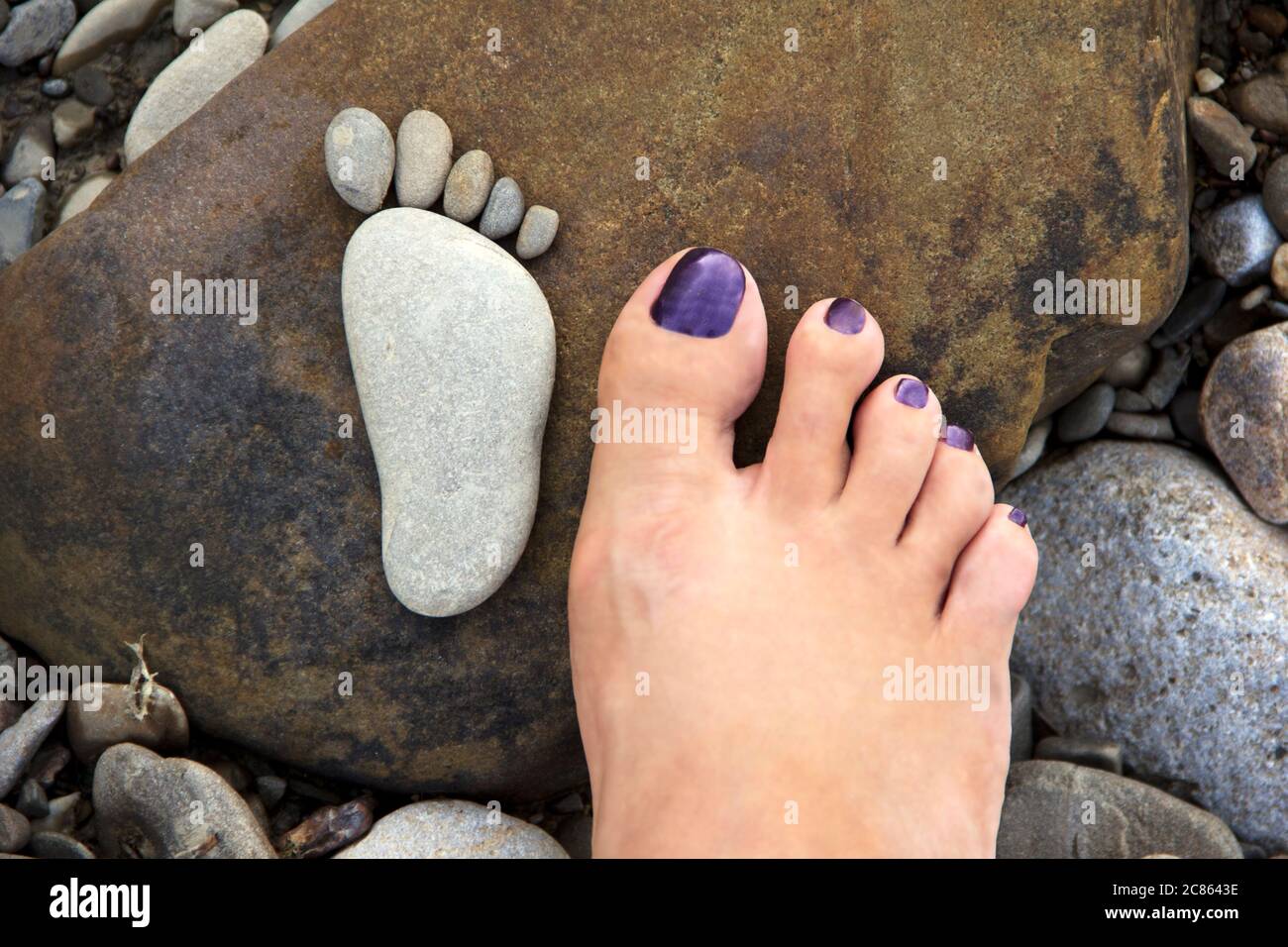 Human concretion hi-res stock photography and images - Alamy