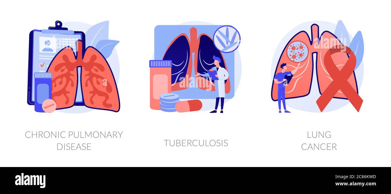 Lung disease abstract concept vector illustrations Stock Vector Image ...