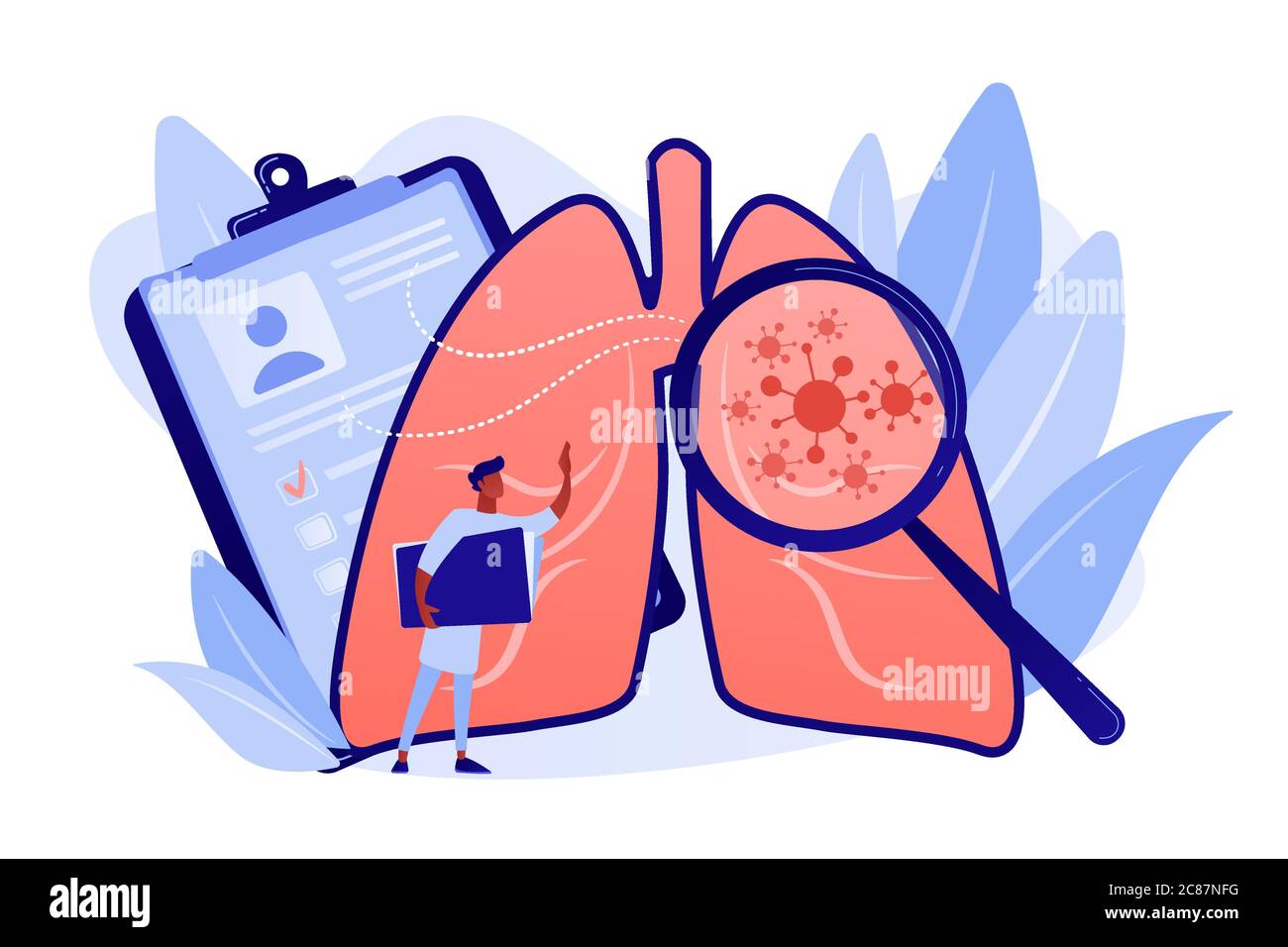 Lung cancer concept vector illustration Stock Vector Image & Art - Alamy
