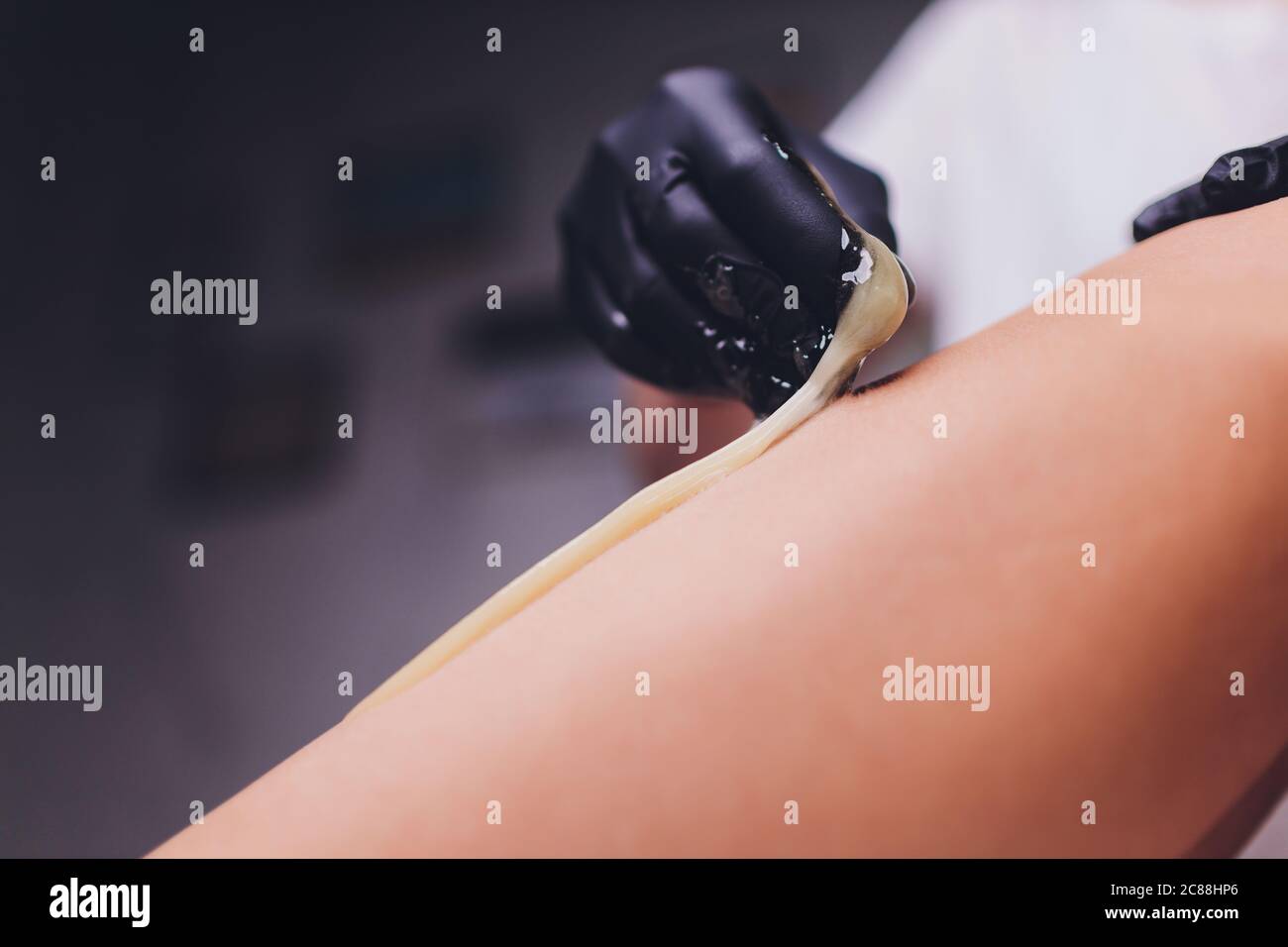 Epilation with liquate sugar at legs hi-res stock photography and ...