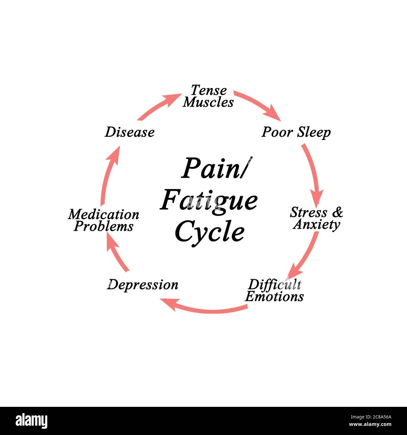 Steps in Pain / Fatigue Cycle Stock Photo - Alamy