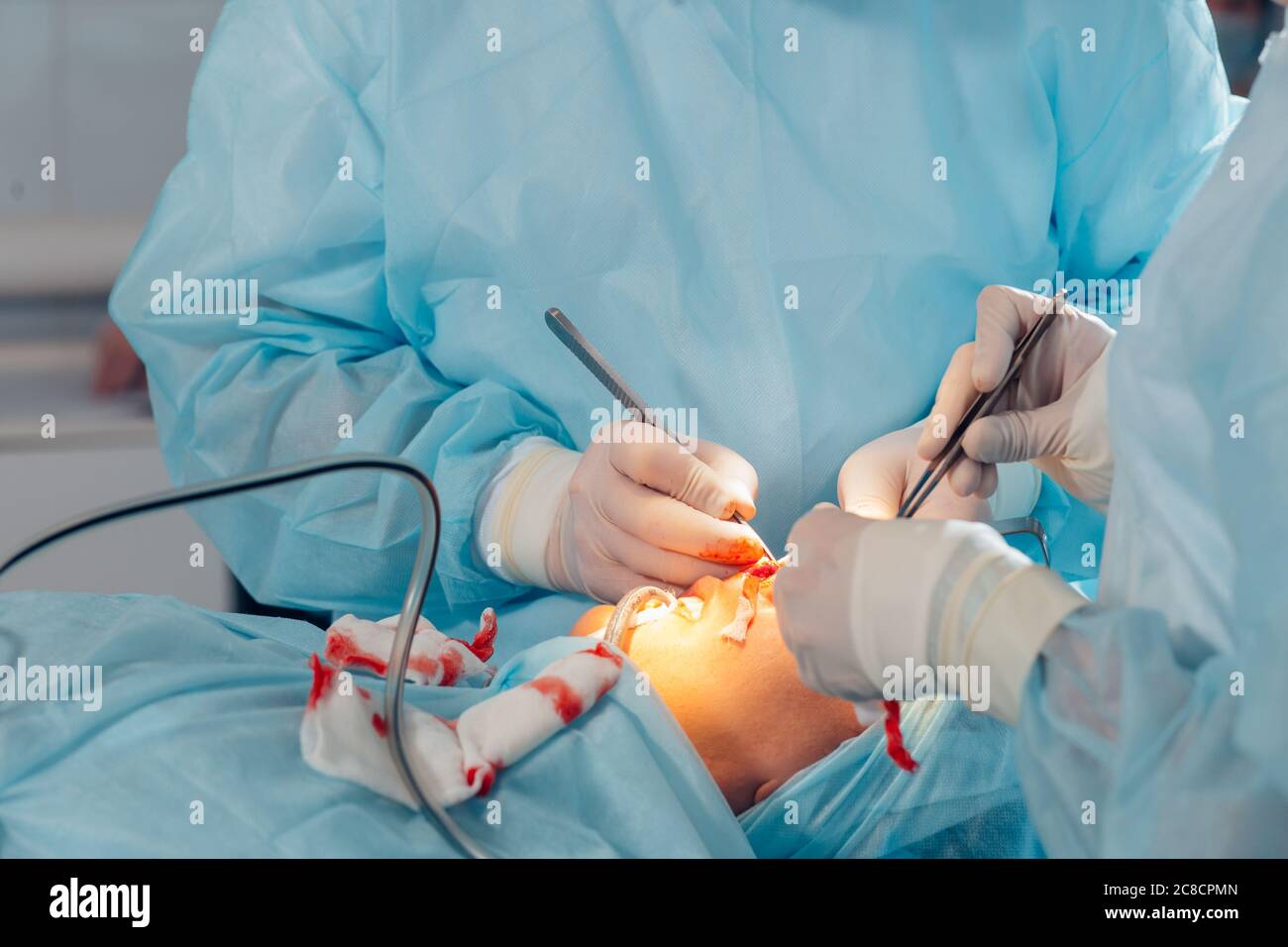 Surgeon wearing gloves operates women's nose. Operation close up Stock ...