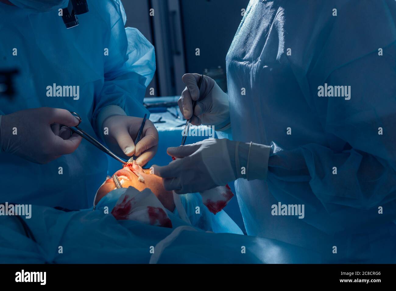 Surgeon and his assistant performing cosmetic surgery on nose in ...