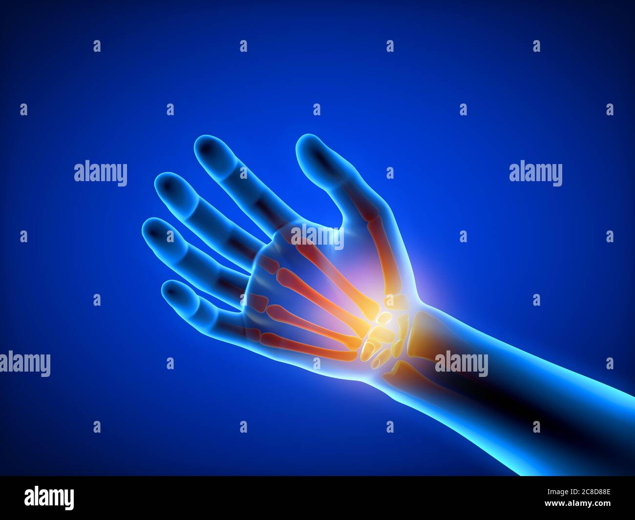 3d rendered medically accurate illustration of a man having a painful ...