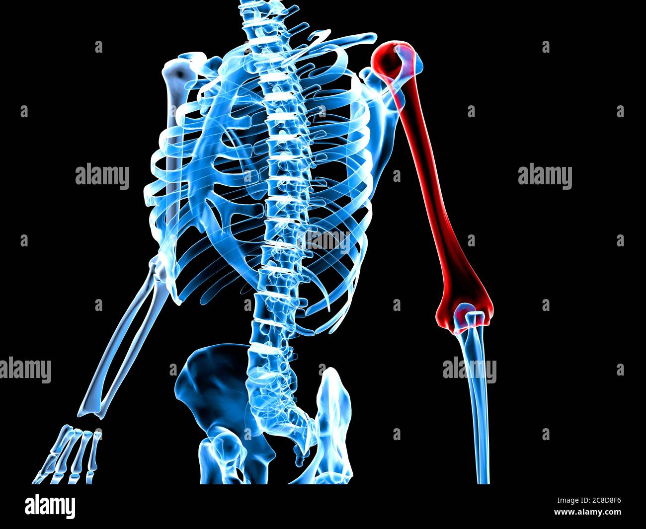 Human arm xray hi-res stock photography and images - Alamy