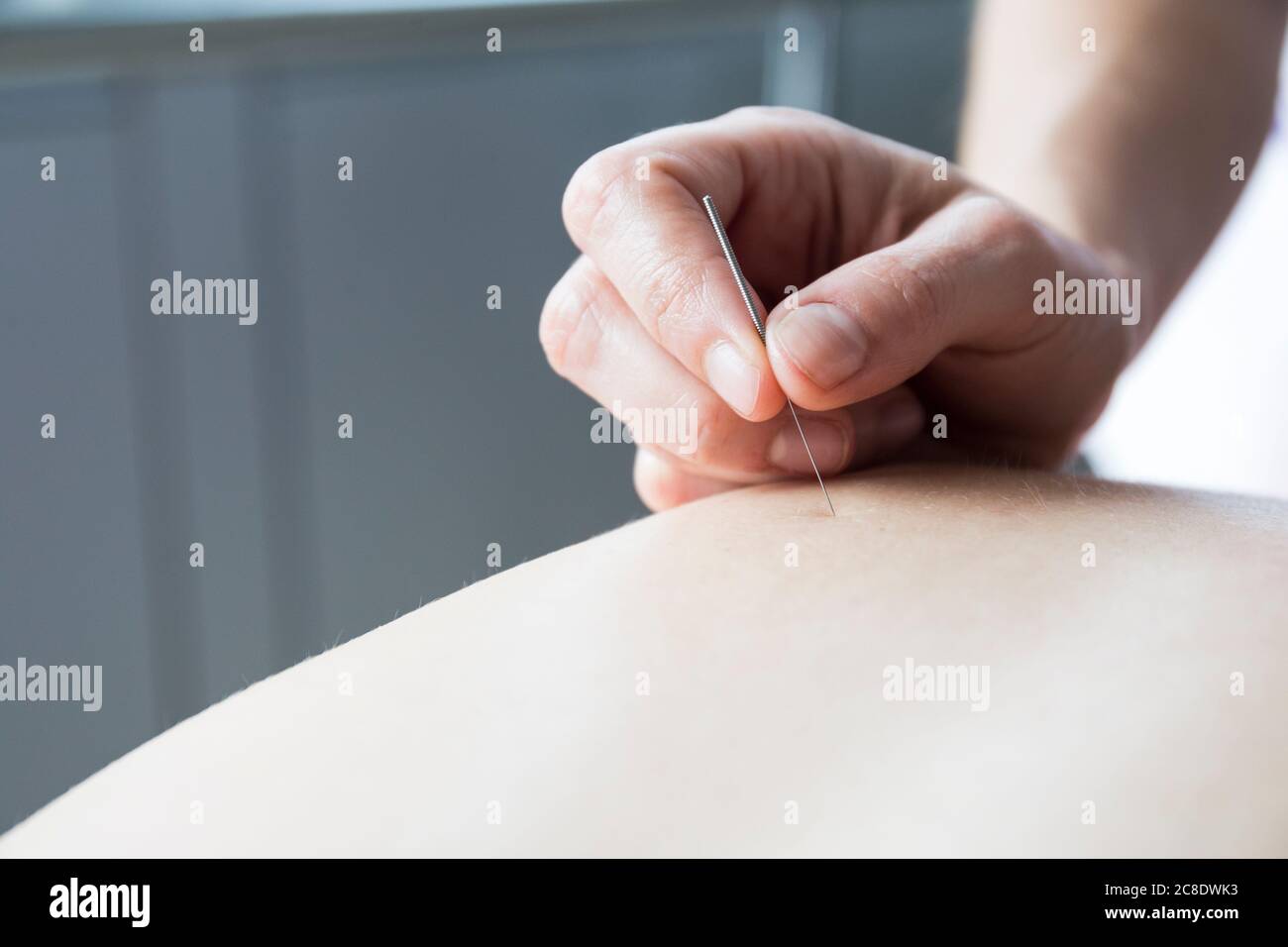 Body needles image hi-res stock photography and images - Alamy