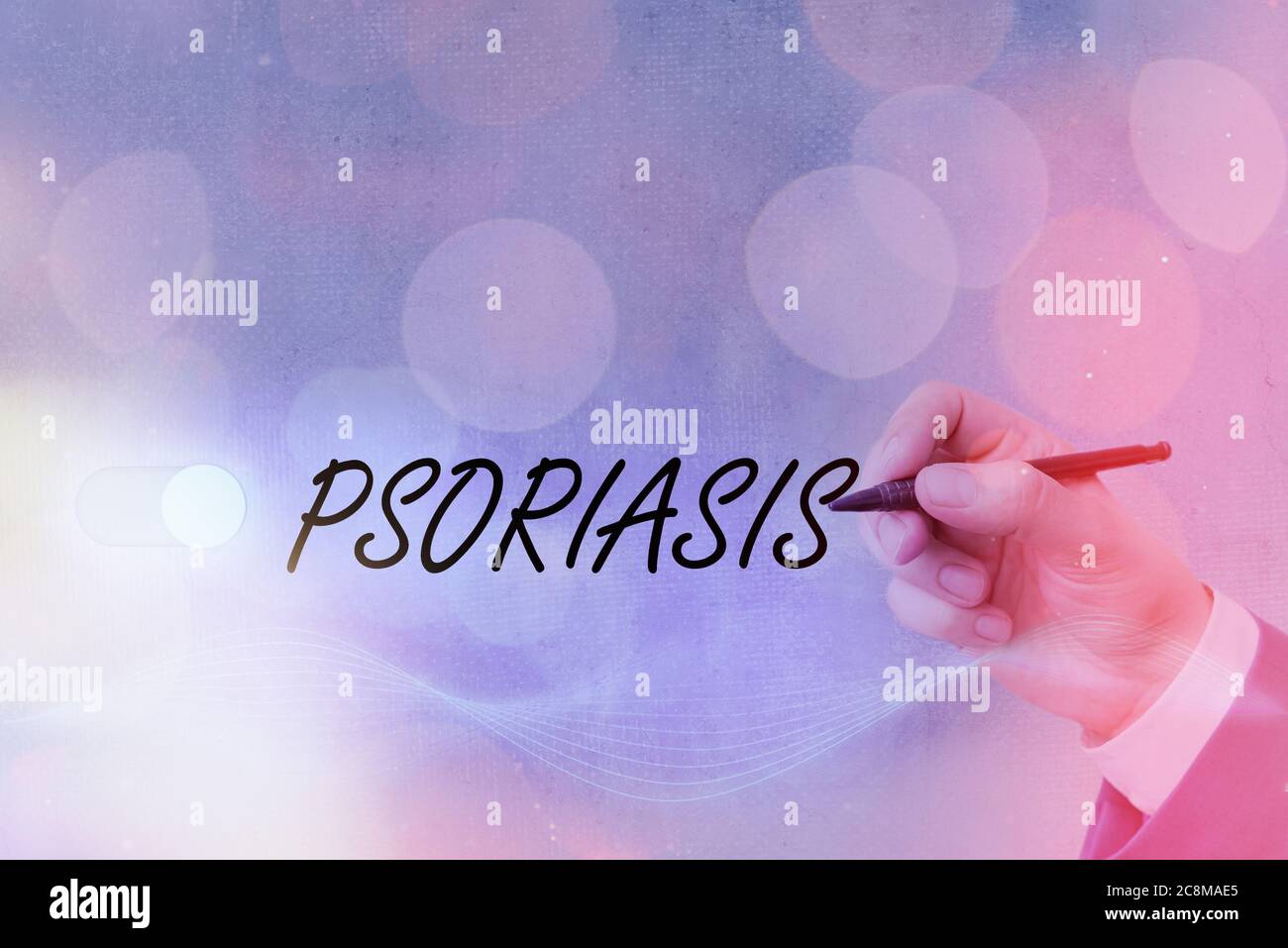 Text sign showing Psoriasis. Business photo text chronic skin disease ...