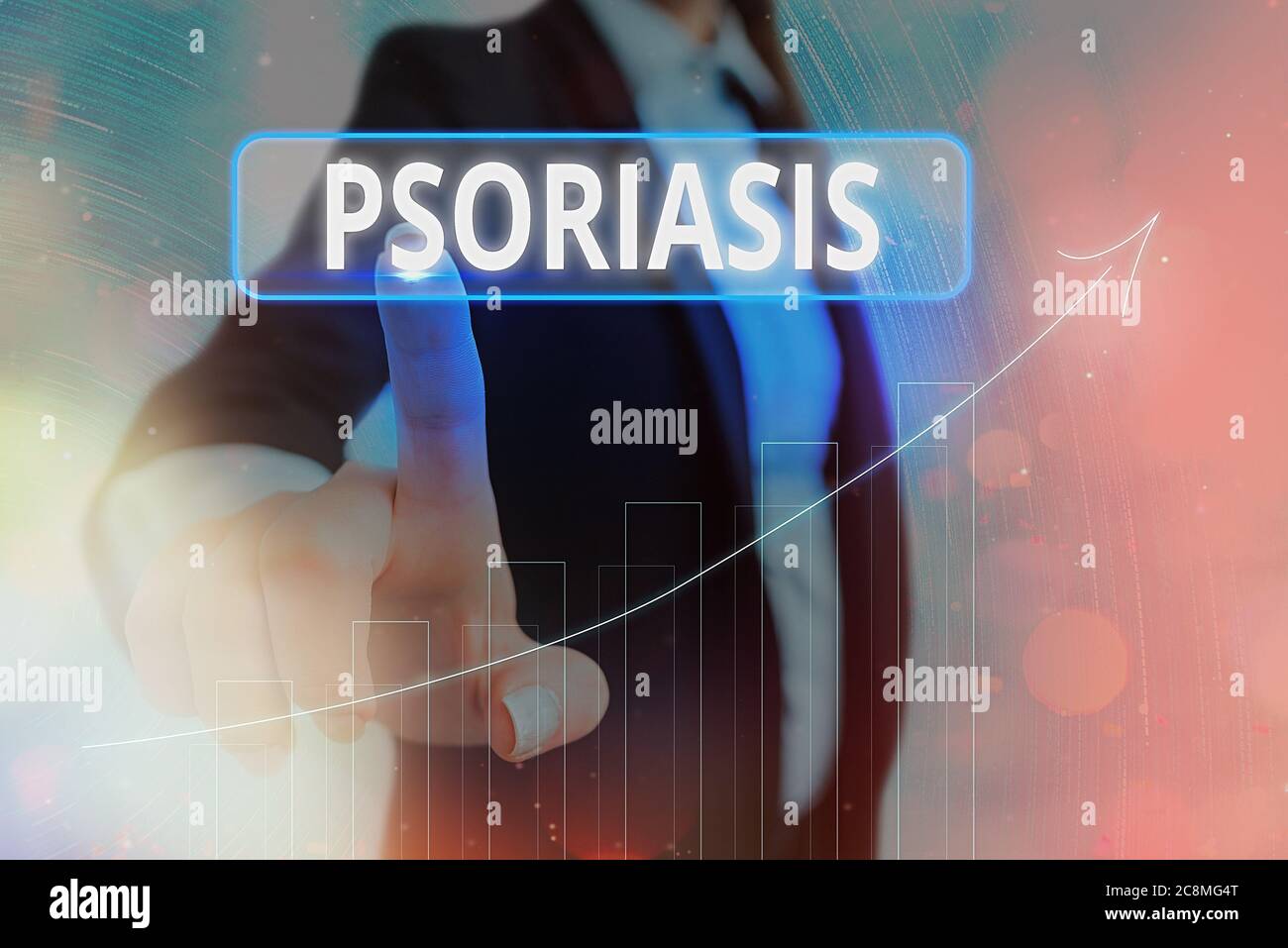 Text sign showing Psoriasis. Business photo showcasing chronic skin ...