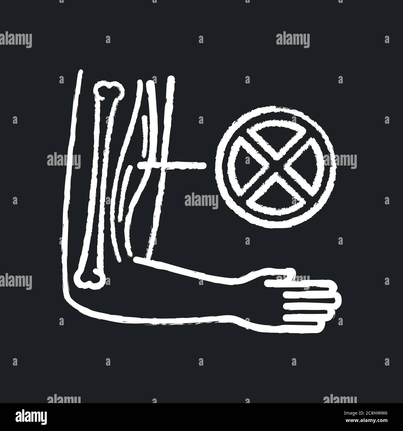 Muscular dystrophy chalk white icon on black background. Chronic ...
