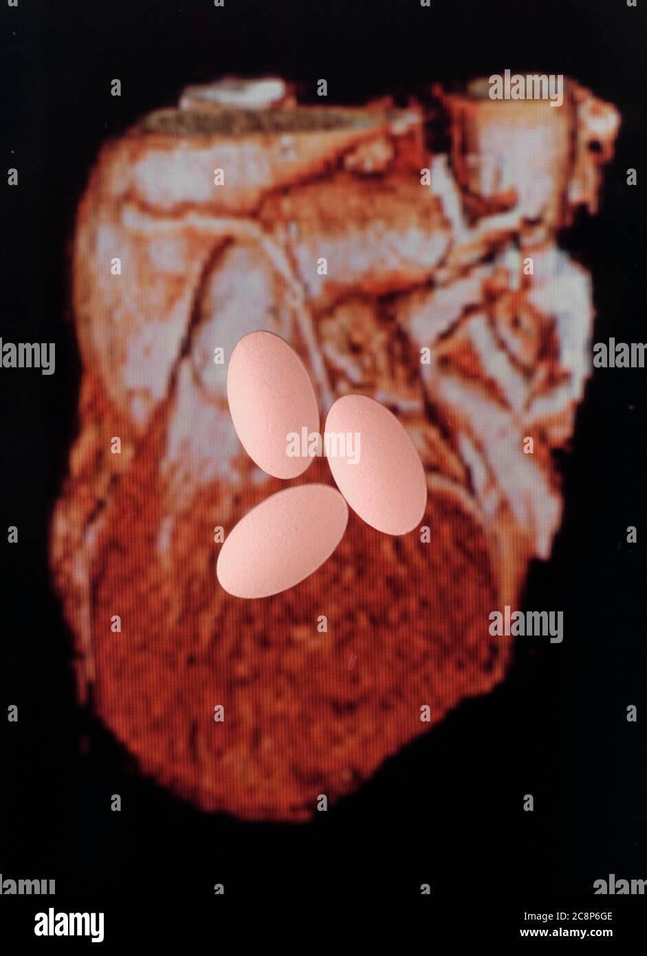 Statins liver hi-res stock photography and images - Alamy