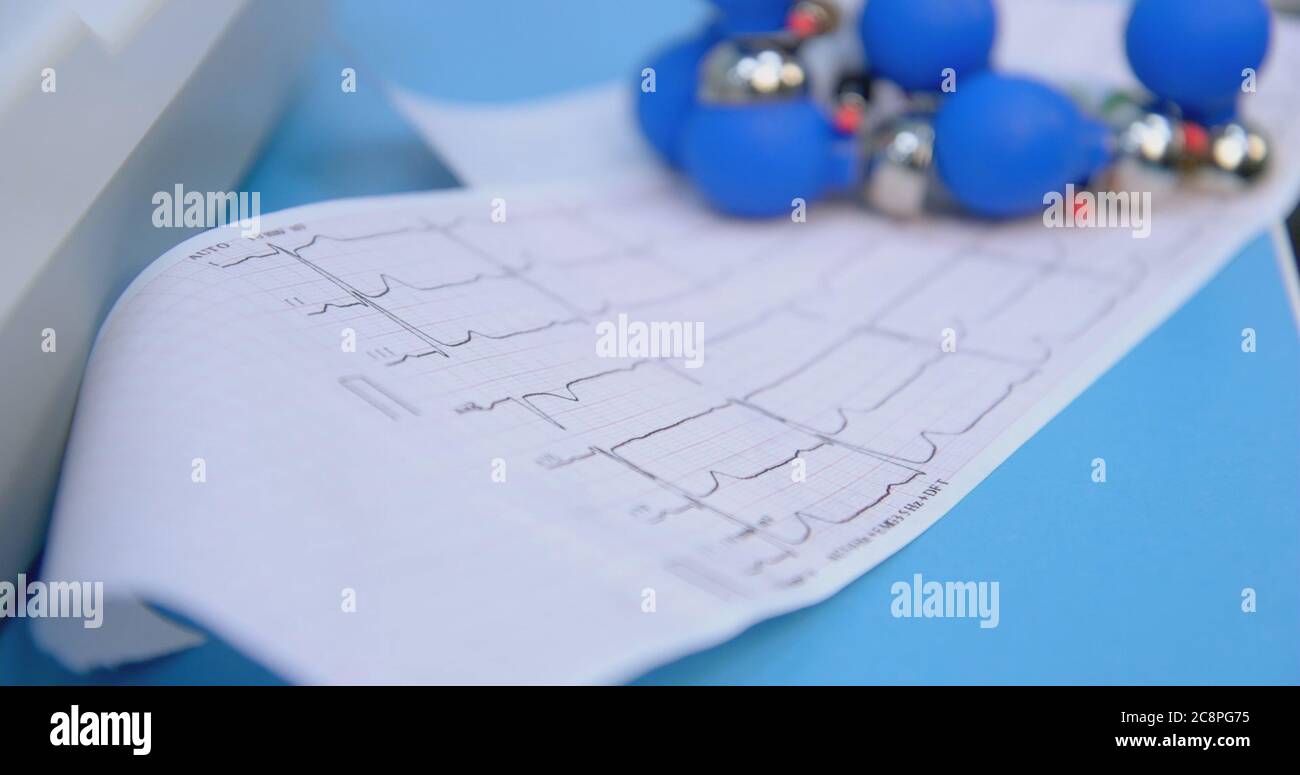 cardiogram measurement device paper tape Stock Photo - Alamy