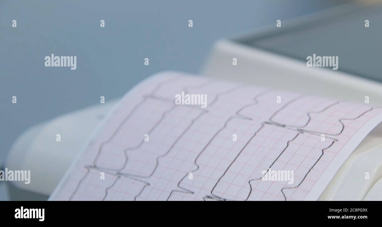 cardiogram measurement device paper tape Stock Photo - Alamy