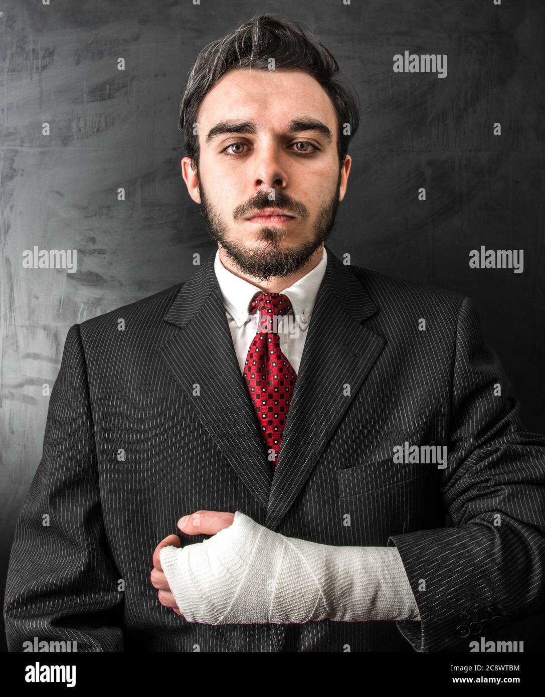 Broken man arm cast hi-res stock photography and images - Alamy