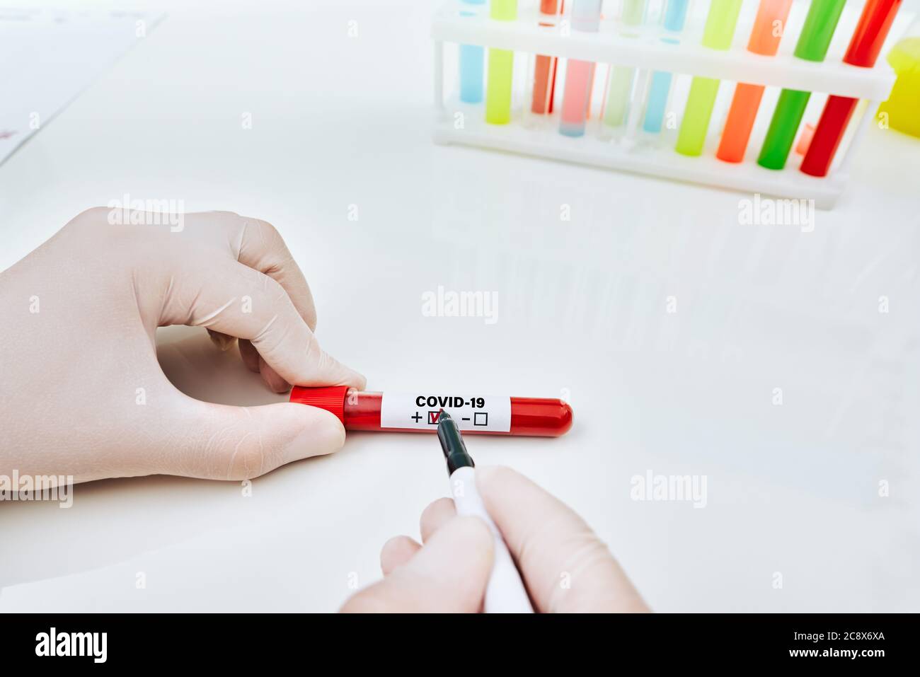 Blood sample test tube with positive result in doctor hands. Diagnosis ...