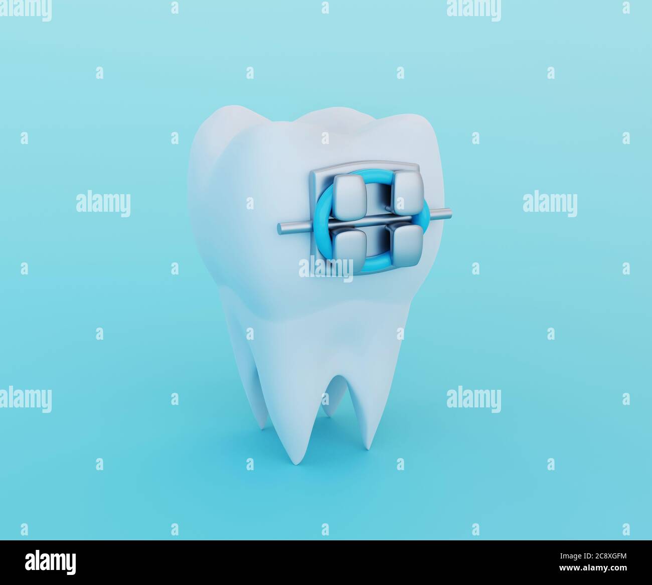 A Tooth with Metal Braces. Care, Orthodontics and Dentistry symbols, 3D ...