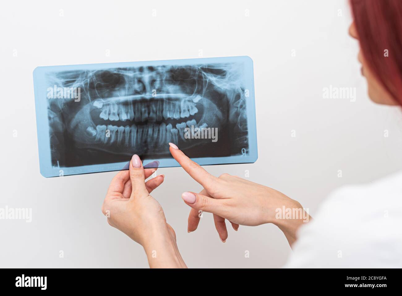 Dentist doctor checking dental x-ray orthopantomogram. Dental panoramic ...