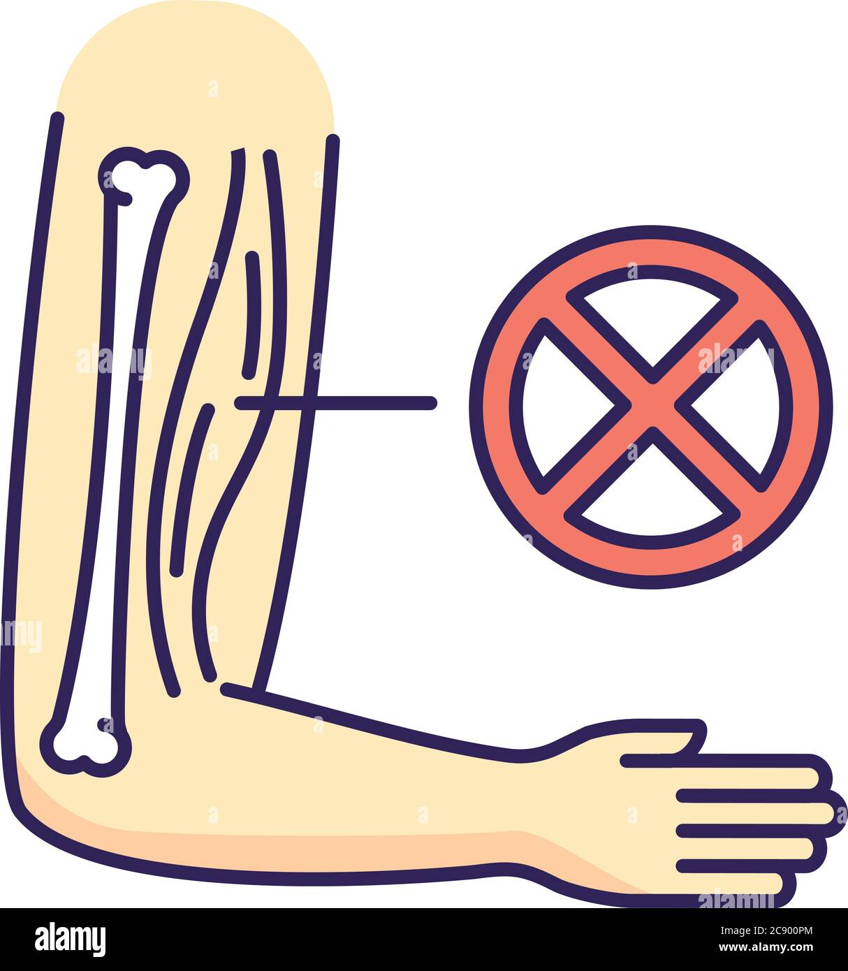Muscular dystrophy RGB color icon. Chronic genetic disorder. Tissue ...