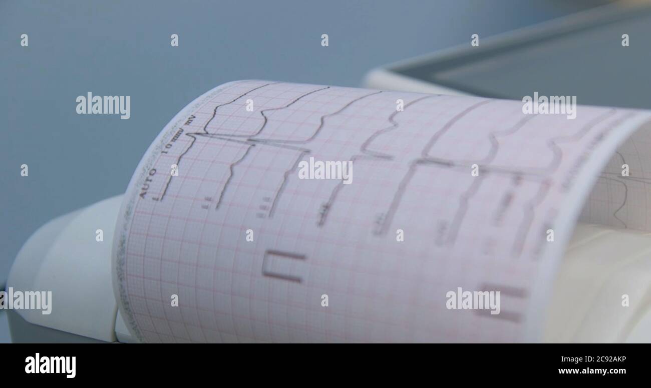 cardiogram measurement device paper tape Stock Photo - Alamy